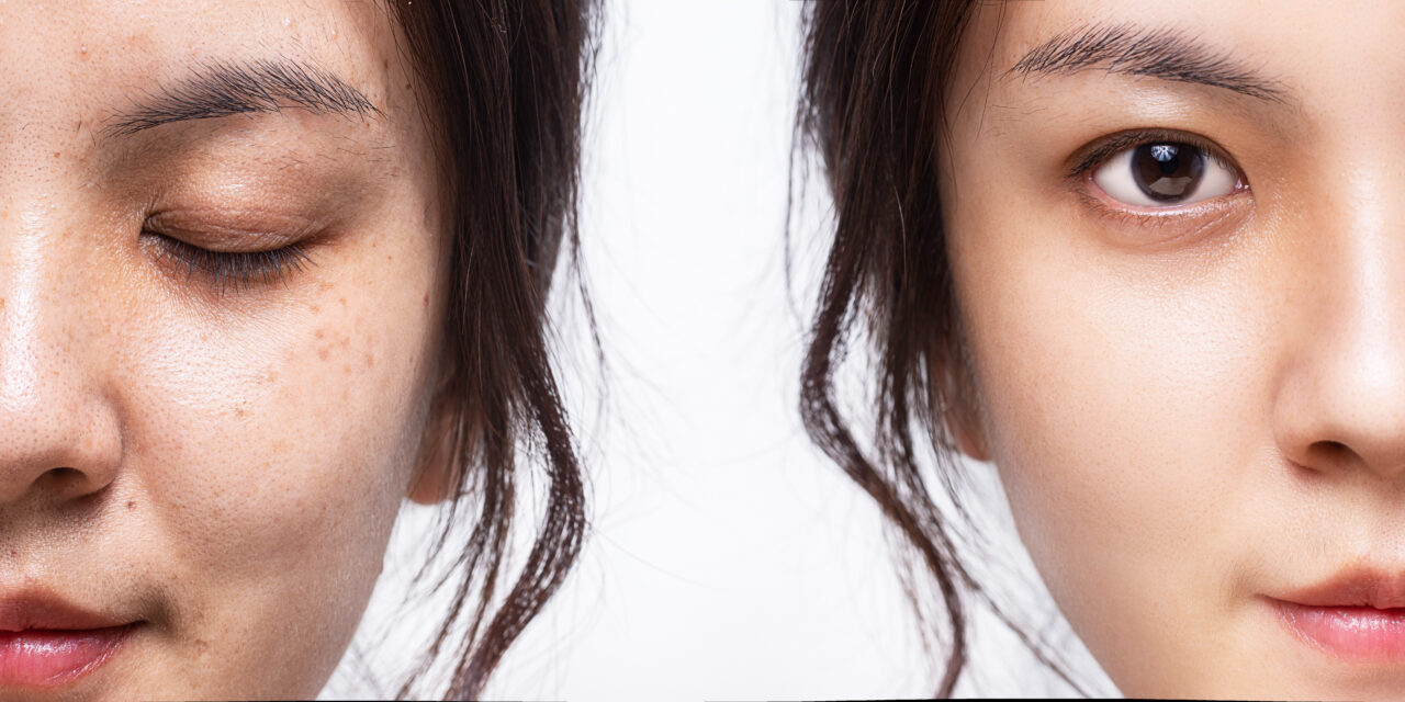 Skin Conditions- Beauty On Rose